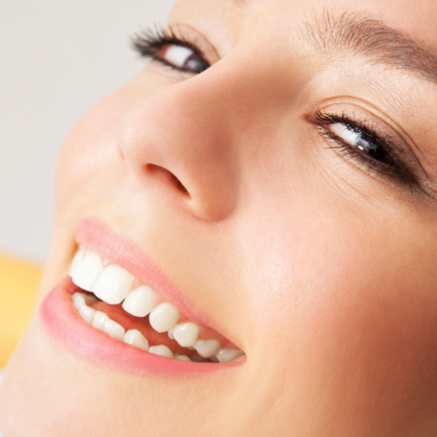 Estética Perioral - Tratamento Laser - Lasermaq